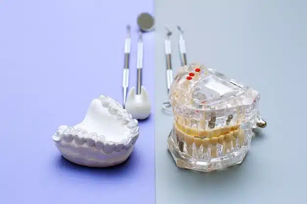 Immediate vs. Complete Dentures - Sphinx